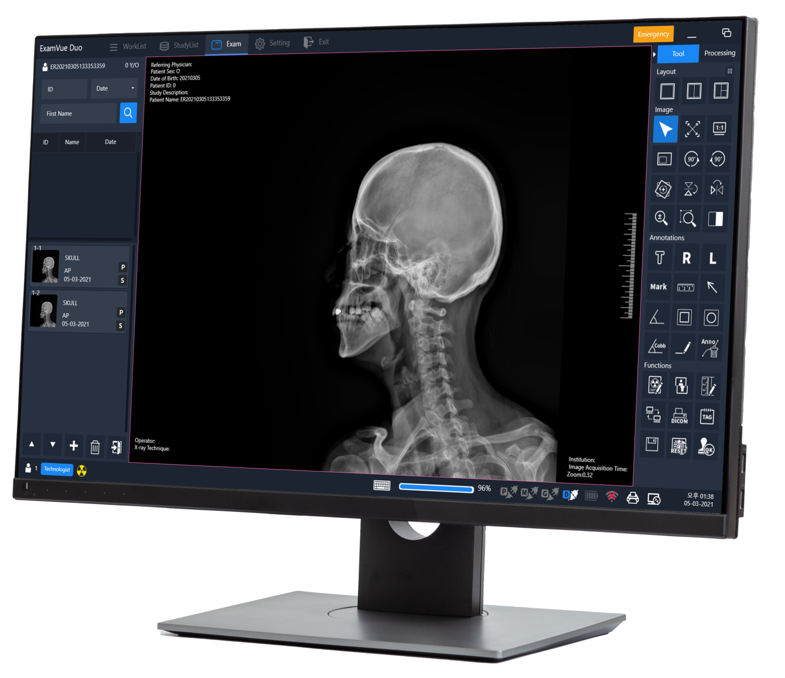 Is all digital x-ray acquisition software equal?