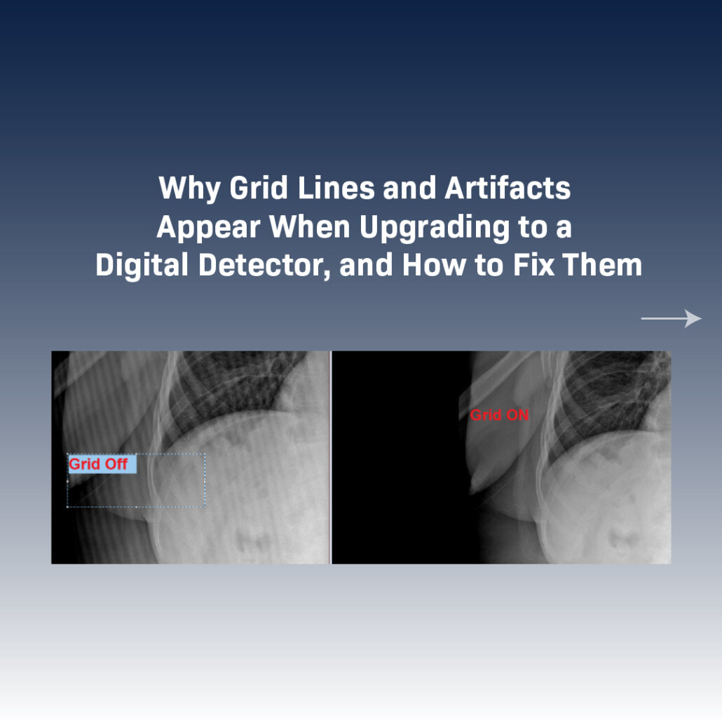 What are X-Ray Grids?
